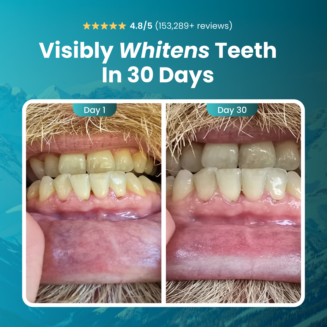 Larineco™️ - Remineralizing Gum